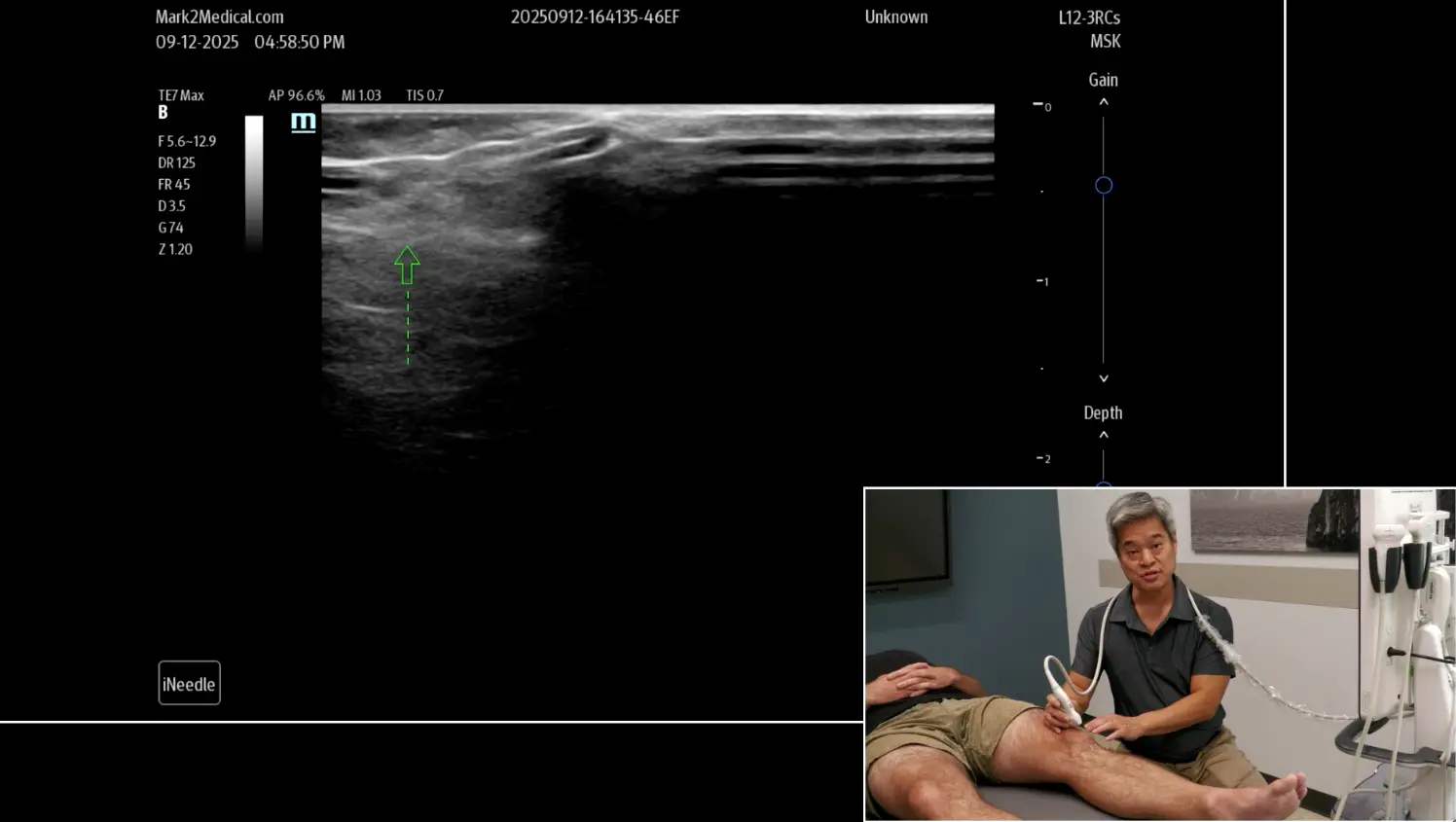 Medial and Lateral Patellar Retinaculum Explained - Regenerative ...